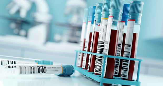Blood Test Results In A Medical Lab - MIMS Ireland