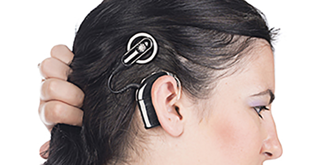 Cochlear Implant 2015 Understanding Cochlear Implants: A Guide For