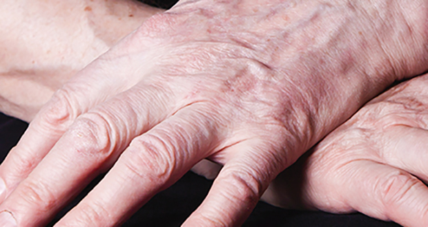 Another winning dermatology textbook