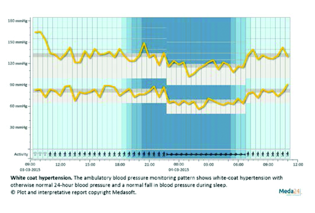 How should ABPM be used in general practice?