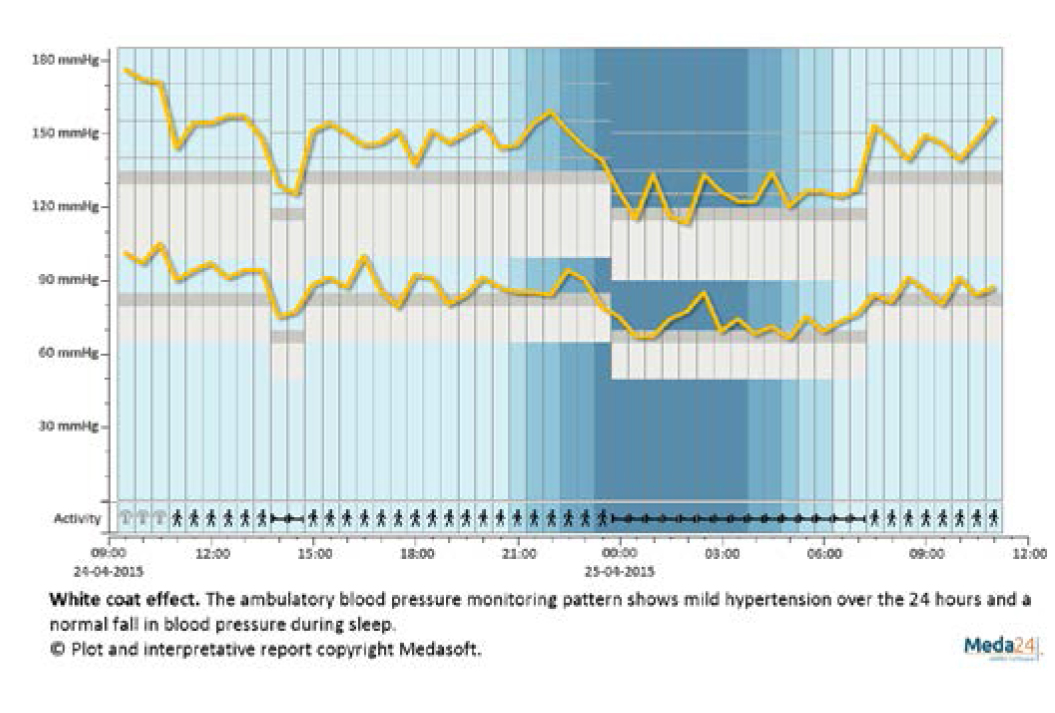 How should ABPM be used in general practice?