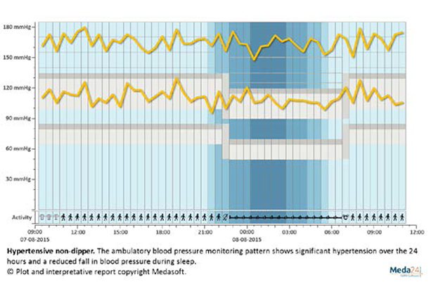 How should ABPM be used in general practice?