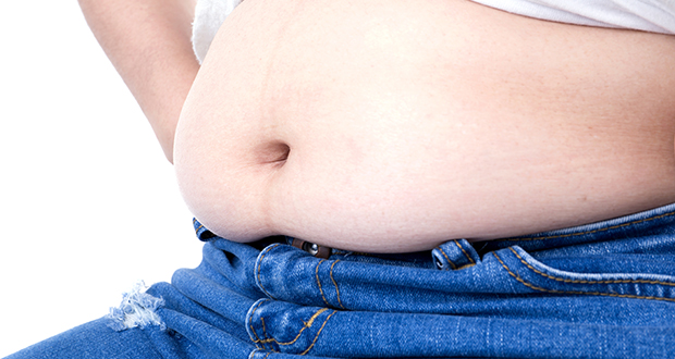 Diabesity — obesity in patients with type 2 diabetes