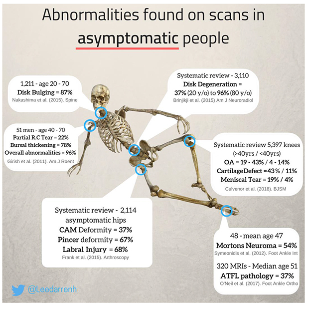 Treating pain in general practice