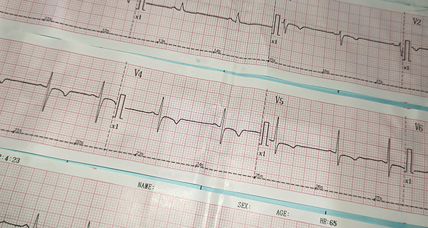 ECT: Time to take a balanced view