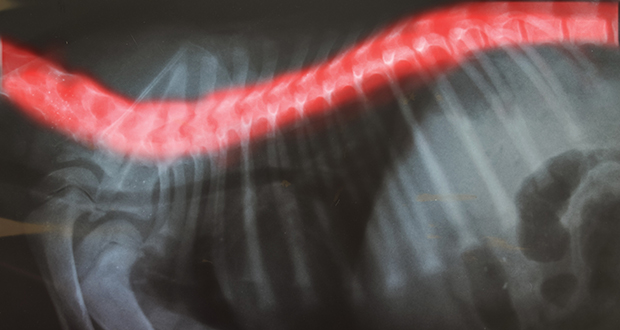 Towards optimal treatment of ankylosing spondylitis: an individualised ...