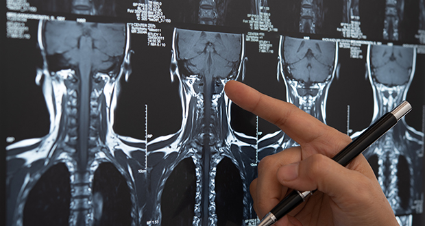 New updated standard levels of ionising radiation for X-ray procedures