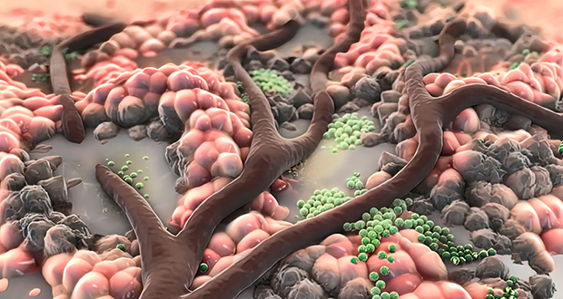 Galway researchers discover potential new method to treat superbug ...