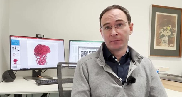 Blood vessel ‘leakiness’ found in long Covid patients with brain fog