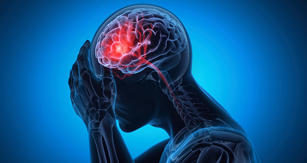 Irish-led research discovery may help prevent epilepsy after brain injury